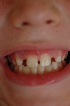 รูปภาพMilchgebiss – เลือกดูภาพถ่ายสต็อก เวกเตอร์ และวิดีโอ63 | Adobe Stock