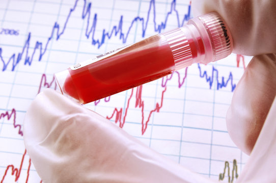 Blutanalyse - Images et vidéos libres de droits | Adobe Stock