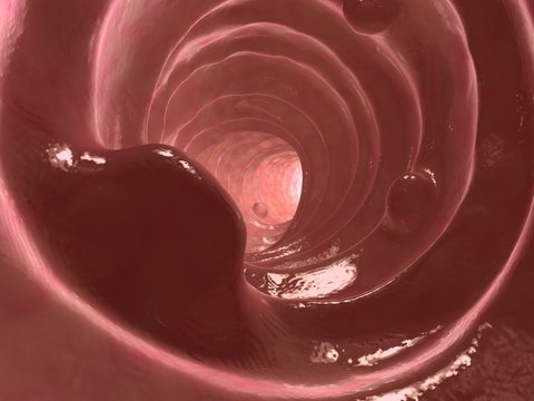 Darmpolypen Images – Parcourir 9 le catalogue de photos, vecteurs et ...