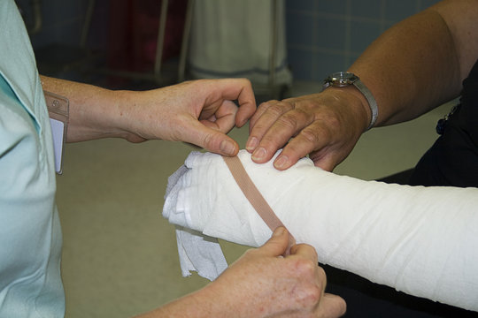 Gipsarm Bilder – Durchsuchen 135 Archivfotos, Vektorgrafiken und Videos ...