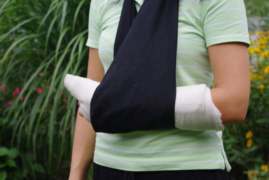 Gipsarm-Bilder: Stock-Fotos & -Videos. | Adobe Stock