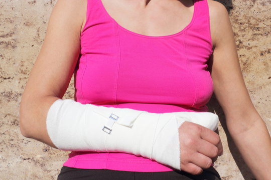 Gipsarm-Bilder: Stock-Fotos & -Videos. | Adobe Stock