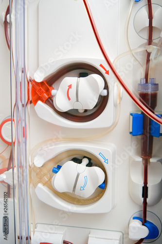 "Close-up dialysis filter of a hemodialysis machine" Stock photo and ...