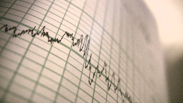 "Medical Graph" Images – Browse 318 Stock Photos, Vectors, and Video ...