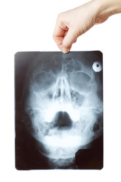 รูปภาพAntritis – เลือกดูภาพถ่ายสต็อก เวกเตอร์ และวิดีโอ101 | Adobe Stock