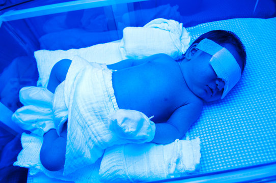 รูปภาพPhototherapy – เลือกดูภาพถ่ายสต็อก เวกเตอร์ และวิดีโอ3,161 ...