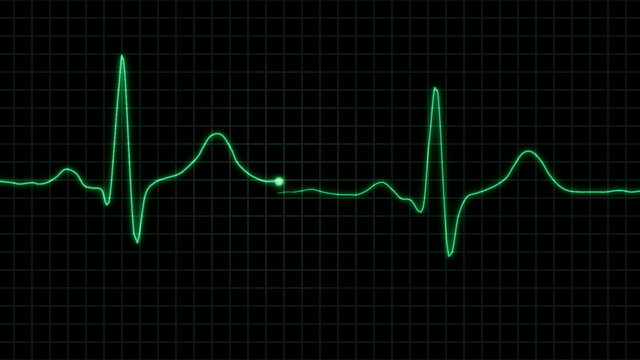 Ekg Monitor Flatline