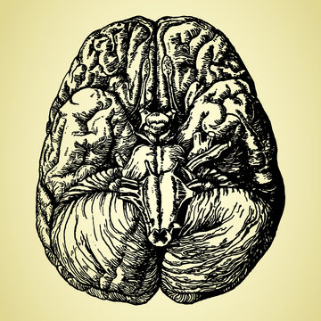 Lobotomy Diagram