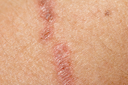 Basaliom-Bilder: Stock-Fotos & -Videos. | Adobe Stock