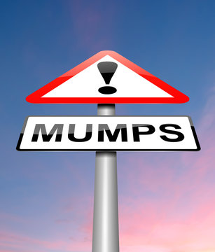 รูปภาพMumps – เลือกดูภาพถ่ายสต็อก เวกเตอร์ และวิดีโอ6,357 | Adobe Stock