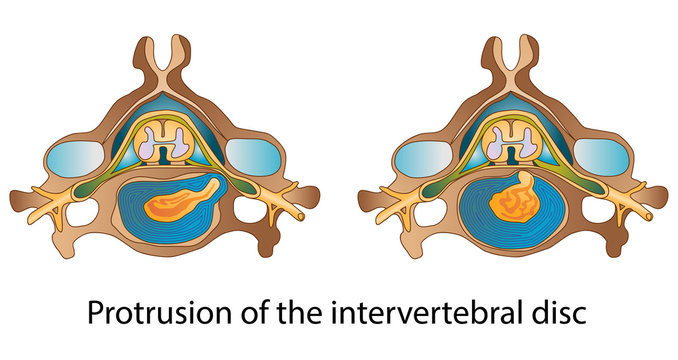 1,113 IMAGES, PHOTOS ET ILLUSTRATIONS VECTORIELLES STOCK APPROPRIÉES ...