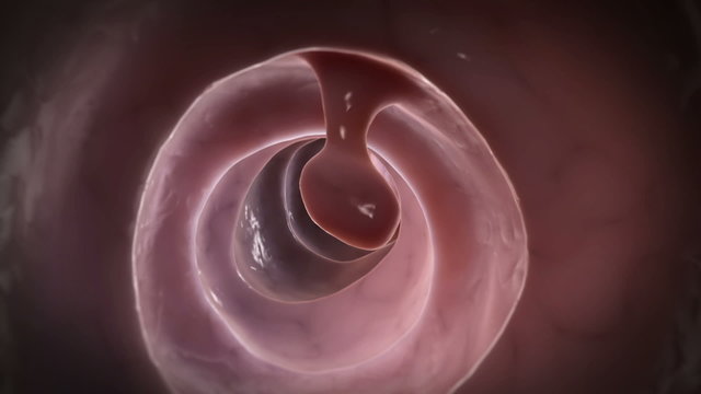 Obrázky Polyp – procházejte fotografie, vektory a videa 31,477 | Adobe ...