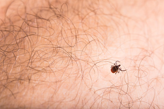 Zeckenbiss Bilder – Durchsuchen 9,460 Archivfotos, Vektorgrafiken und ...