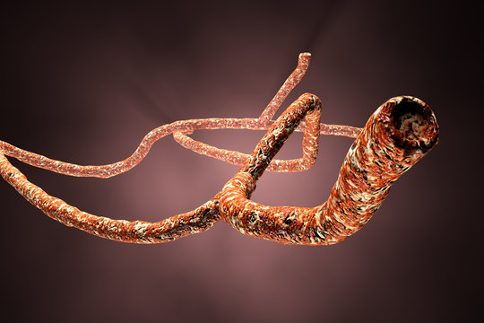 Epidem Images – Browse 39 Stock Photos, Vectors, and Video | Adobe Stock