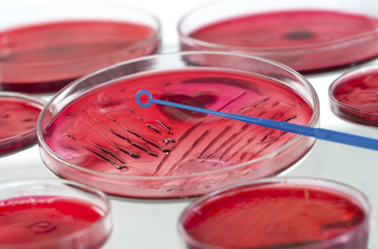 Repiquage Images – Browse 269 Stock Photos, Vectors, and Video | Adobe ...