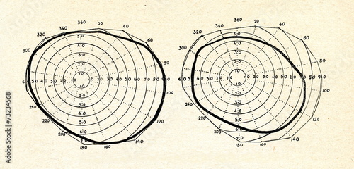 "Perimetry charts, showing the field of vision" Stock photo and royalty ...