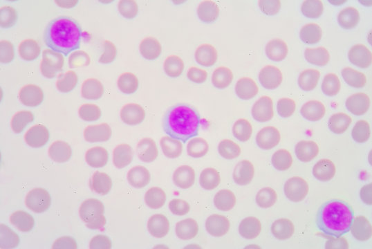 รูปภาพMetamyelocyte – เลือกดูภาพถ่ายสต็อก เวกเตอร์ และวิดีโอ96 | Adobe ...