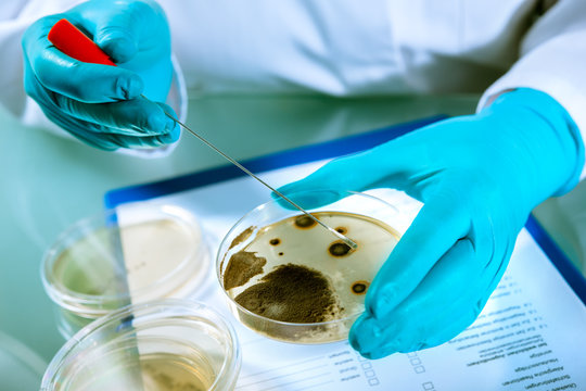「Mrsa-Keim」の写真素材 | 45件の無料イラスト画像 | Adobe Stock