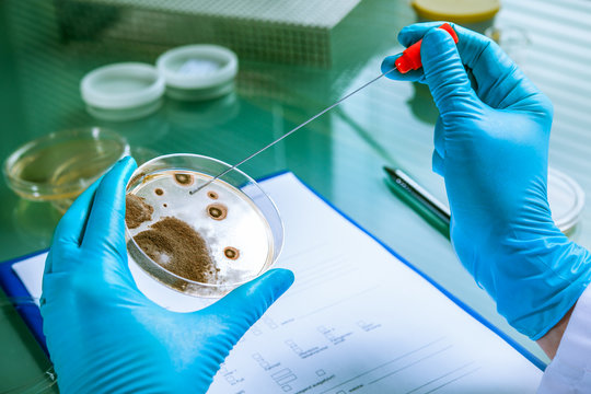 「Mrsa-Keim」の写真素材 | 45件の無料イラスト画像 | Adobe Stock