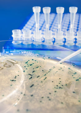 Microbal Bilder – Durchsuchen 81 Archivfotos, Vektorgrafiken und Videos ...