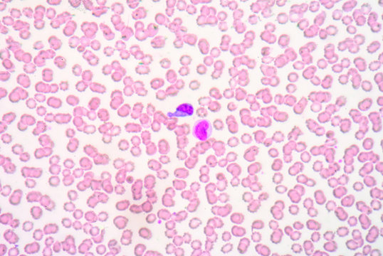 รูปภาพMetamyelocyte – เลือกดูภาพถ่ายสต็อก เวกเตอร์ และวิดีโอ142 | Adobe ...