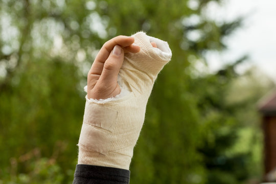 Gipsarm-Bilder: Stock-Fotos & -Videos. | Adobe Stock