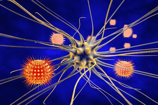Neuroinfection Images – Browse 56 Stock Photos, Vectors, and Video ...