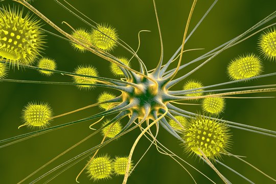 Neuroinfection Images – Browse 56 Stock Photos, Vectors, and Video ...