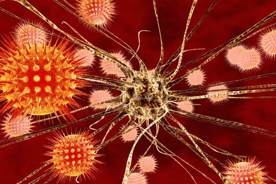 Neuroinfection Images – Browse 56 Stock Photos, Vectors, and Video ...