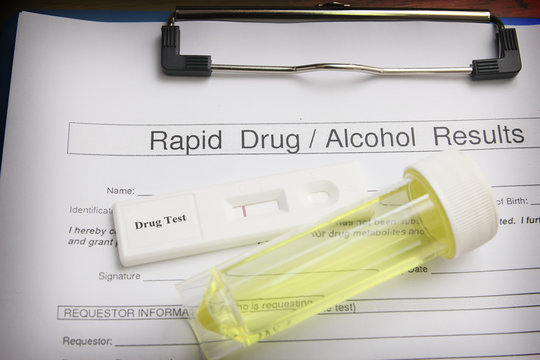 "Drug Test" Imej – Semak Imbas 167 Foto, Vektor dan Video Stok | Adobe ...