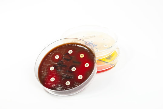 Antibiogram Images – Browse 97 Stock Photos, Vectors, and Video | Adobe ...