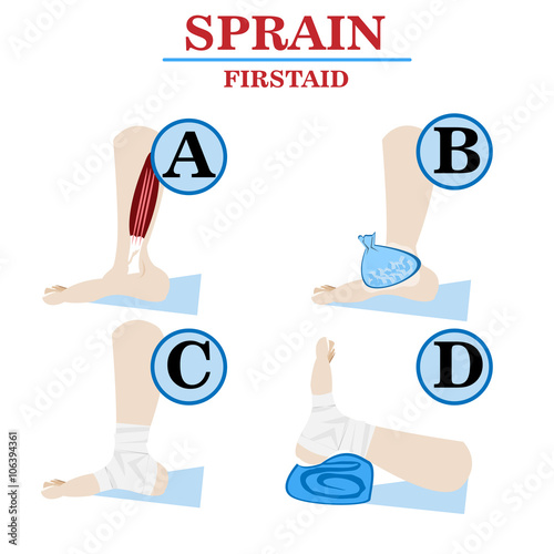 "Sprain firstaid vector infographic image" Stock image and royalty-free ...