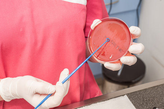 รูปภาพMammite – เลือกดูภาพถ่ายสต็อก เวกเตอร์ และวิดีโอ6 | Adobe Stock