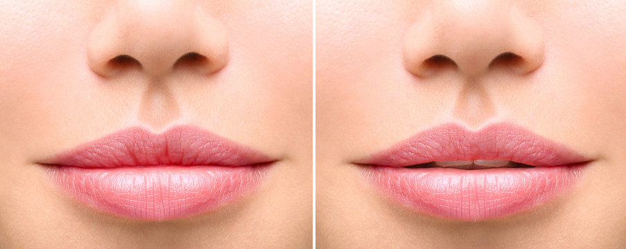 LAS 1,680,236 MEJORES IMÁGENES, FOTOS DE ARCHIVO Y VECTORES DE Labio ...