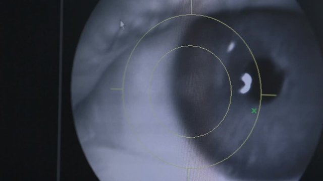 Refractometry 이미지 – 찾아보기 487 스톡 사진, 벡터 및 비디오 | Adobe Stock