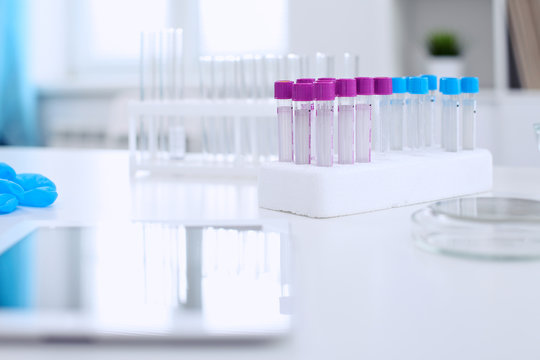 รูปภาพReagents – เลือกดูภาพถ่ายสต็อก เวกเตอร์ และวิดีโอ66,411 | Adobe Stock