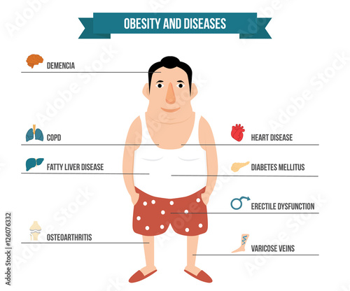 "Obesity and internal organ diseases illustration. Fat man with anatomy ...