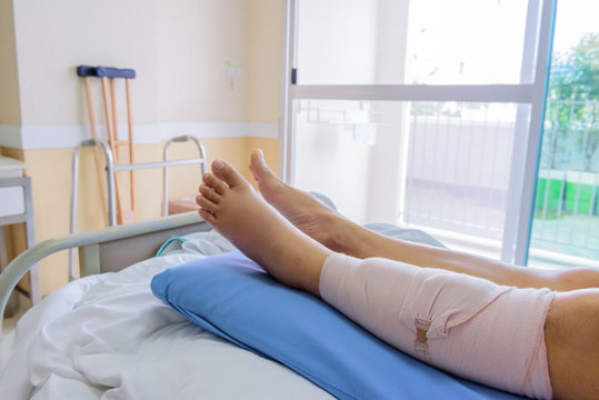 Broken Leg Hospital Images – Browse 26,275 Stock Photos, Vectors, and ...
