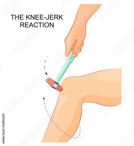 "the knee-jerk reflex" Stock image and royalty-free vector files on ...