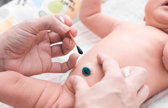 รูปภาพNavel-String – เลือกดูภาพถ่ายสต็อก เวกเตอร์ และวิดีโอ75 | Adobe Stock