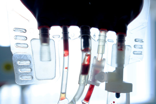 Imagens de Hemotransfusion – Explore Fotografias do Stock, Vetores e ...