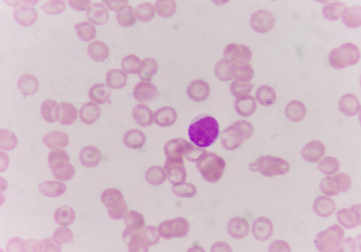 Microcyte Bilder – Durchsuchen 391 Archivfotos, Vektorgrafiken und ...