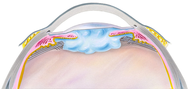 รูปภาพPhaco – เลือกดูภาพถ่ายสต็อก เวกเตอร์ และวิดีโอ331 | Adobe Stock