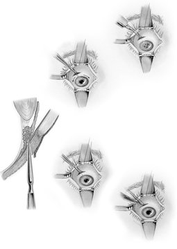 รูปภาพPhaco – เลือกดูภาพถ่ายสต็อก เวกเตอร์ และวิดีโอ331 | Adobe Stock