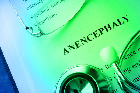 Anencephalus-Bilder: Stock-Fotos & -Videos. | Adobe Stock