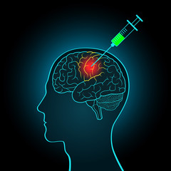 Tabla de tumor cerebral y médico | Vector Gratis