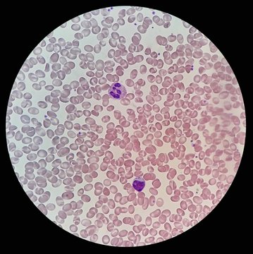 Ovalocytes Images – Browse 90 Stock Photos, Vectors, and Video | Adobe ...