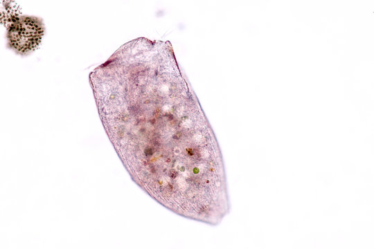 Stentor Under Microscope 400x