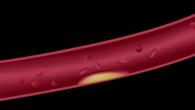 Clotting Images – Browse 59,404 Stock Photos, Vectors, and Video ...