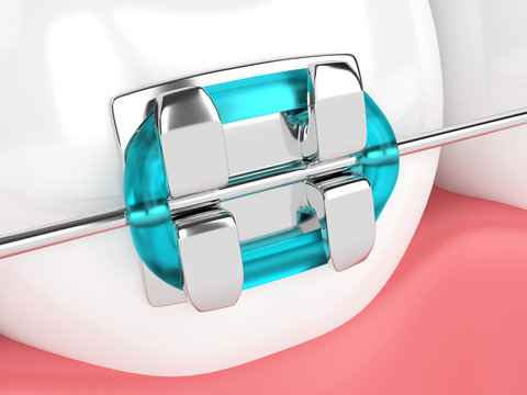 รูปภาพBrace – เลือกดูภาพถ่ายสต็อก เวกเตอร์ และวิดีโอ191,632 | Adobe Stock